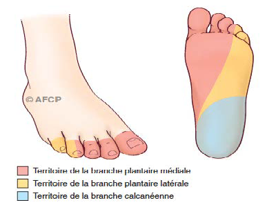 Syndrome Tunnel tarsien