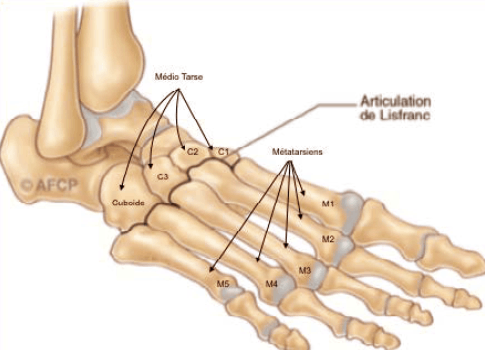 Traumatismes du Lisfranc